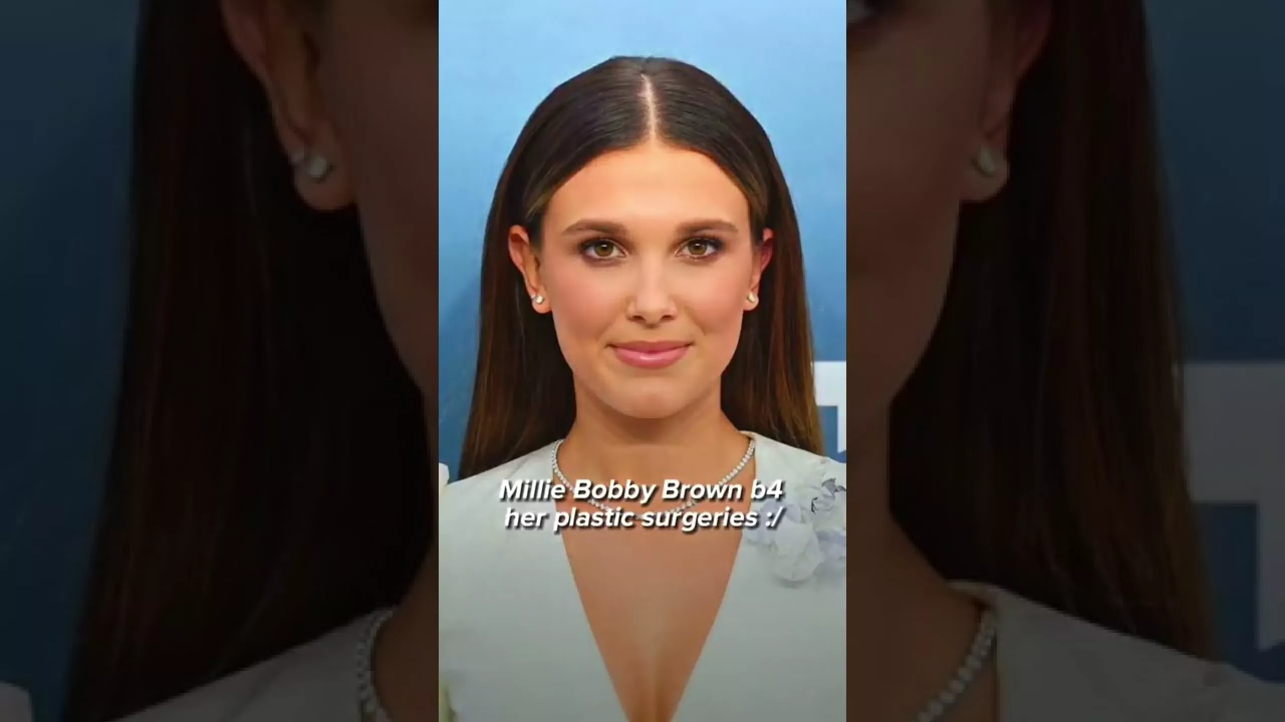 Millie Bobby Brown Before Her Plastic Surgeries Clothes Outfits